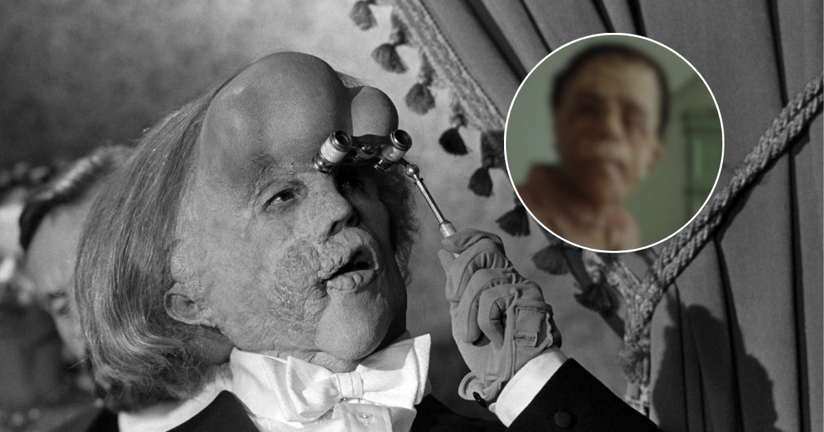 The Elephant Man torna con un nuovo remake. E la scelta del ...